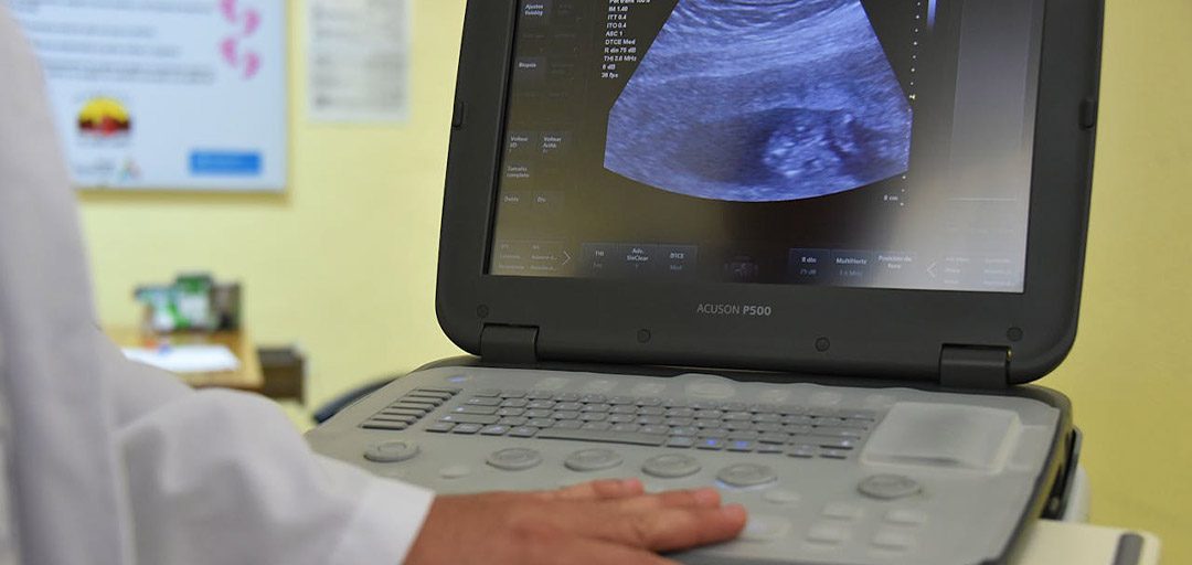 3D/4D Ultrasound DSR Path Labs - Trusted & Best Diagnostics in Bhiwani ...